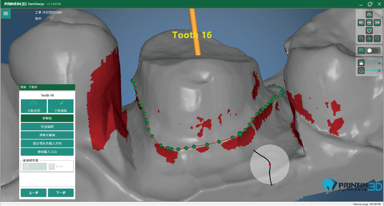 en_Dental_Crown_Design_Software - 品印三維